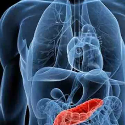 Tumore al pancreas, speranze per la cura