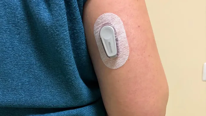 Per il diabete arriva il cerotto per l'insulina
